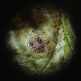 [MICROSCOPE] J'ai trouvé une petite AMIBE :cute: sur le forum Blabla 18 ...