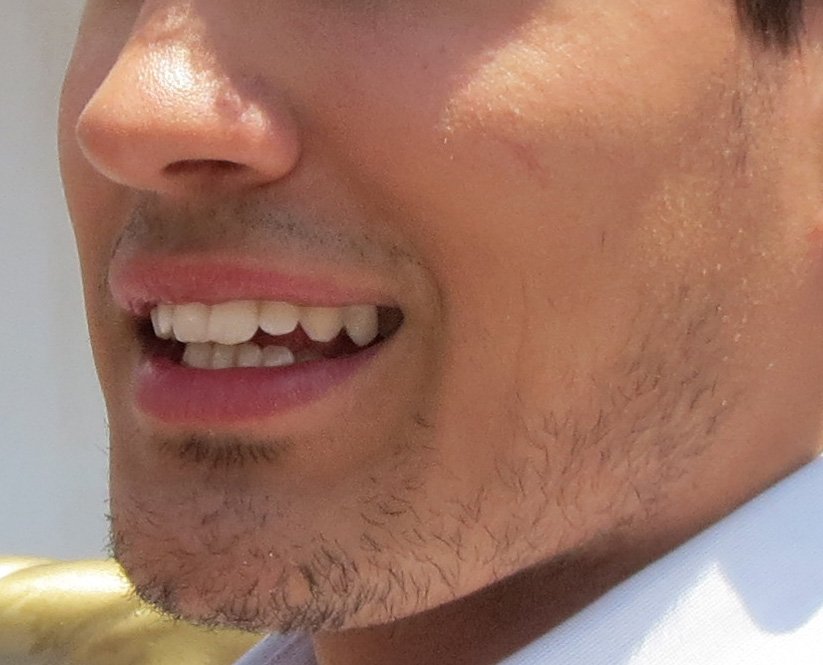 [Photo] Raser ou pas raser sur le forum Blabla 18-25 ans - 09-05-2014 ...