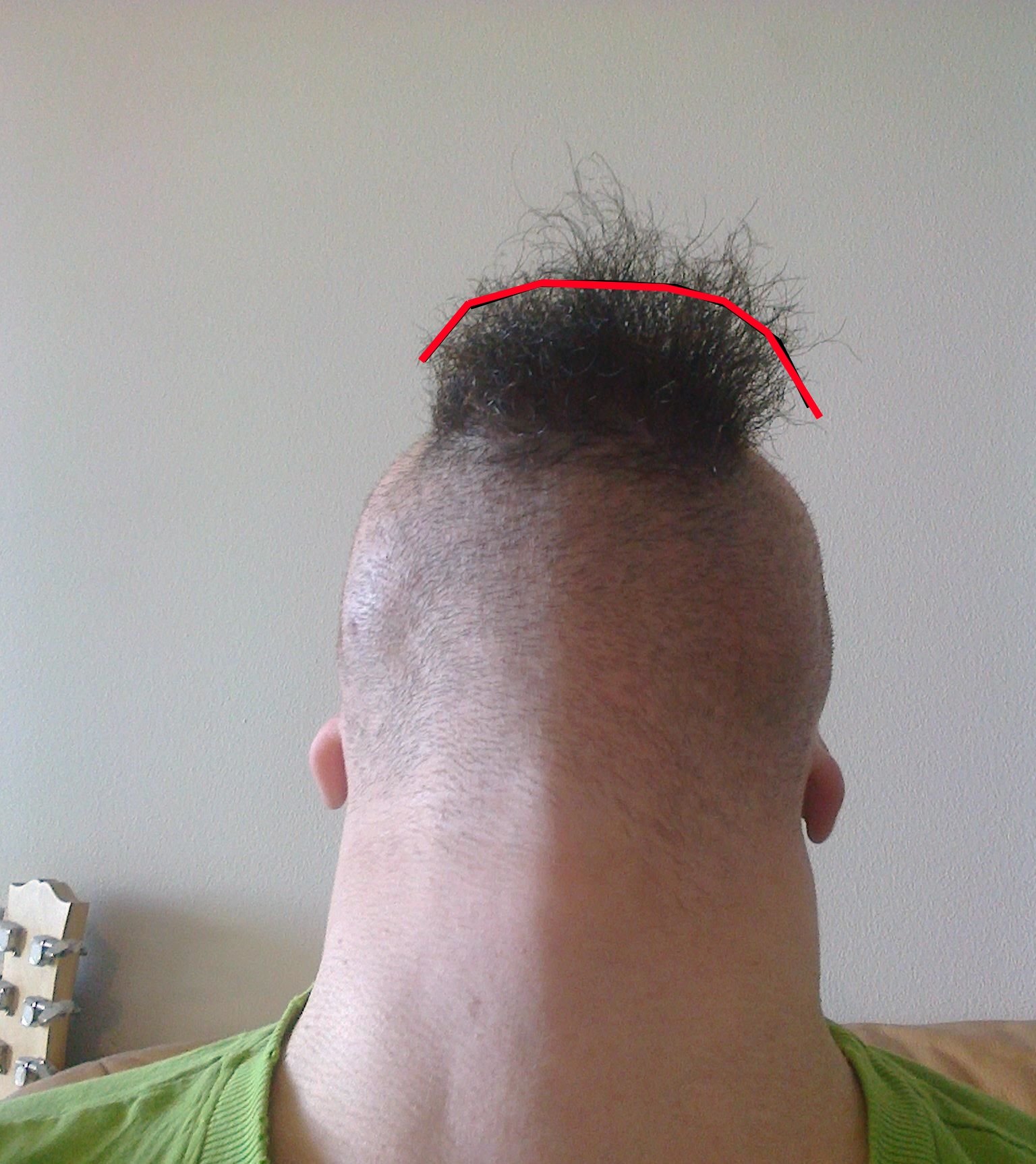 [Photo] Le coiffeur a raté mon dégradé je crois, votre avis ? sur le ...