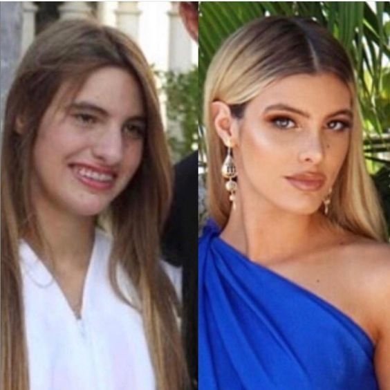 Ca vous dérange de sortir avec une moche qui est devenu belle grâce à ...