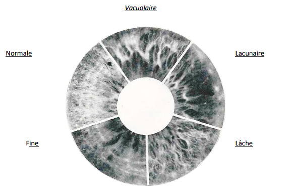 [IRIDOLOGIE] Comprendre Enfin Les Yeux sur JvArchive forum 18-25 ...