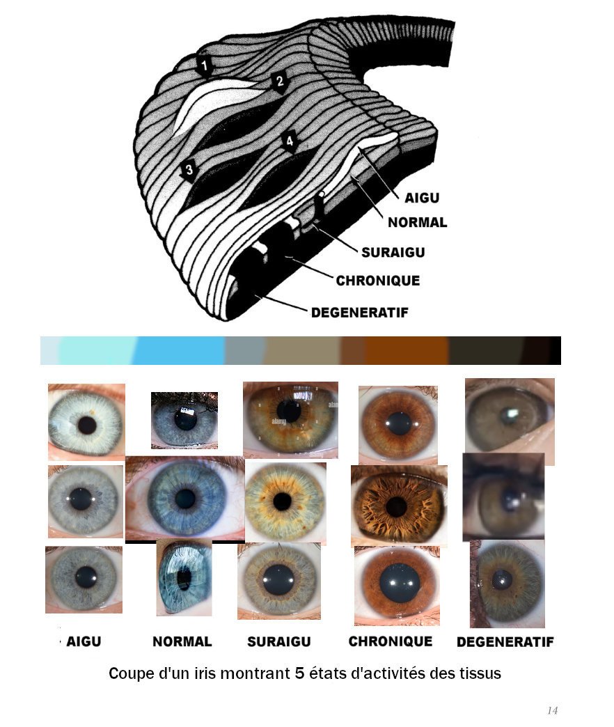 [IRIDOLOGIE] Comprendre Enfin Les Yeux sur JvArchive forum 18-25 ...
