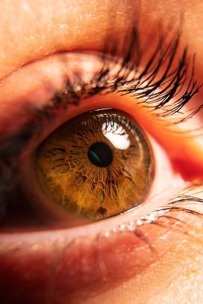 [IRIDOLOGIE] Comprendre Enfin Les Yeux sur JvArchive forum 18-25 ...