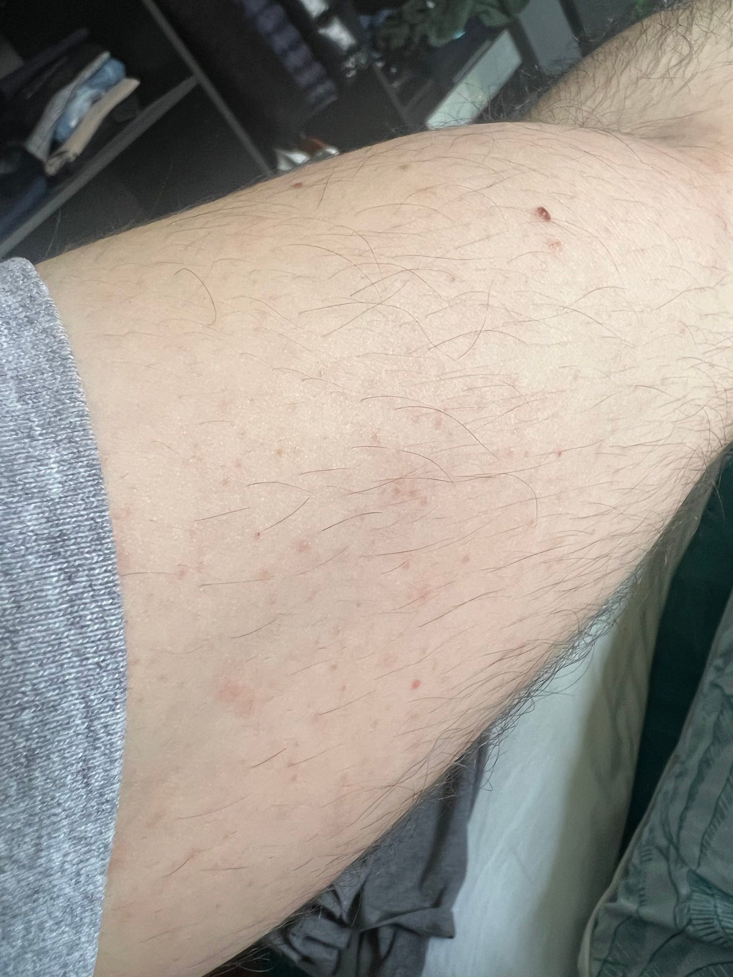 Pleins de petits boutons et plaques rouges depuis quelques jours sur le ...