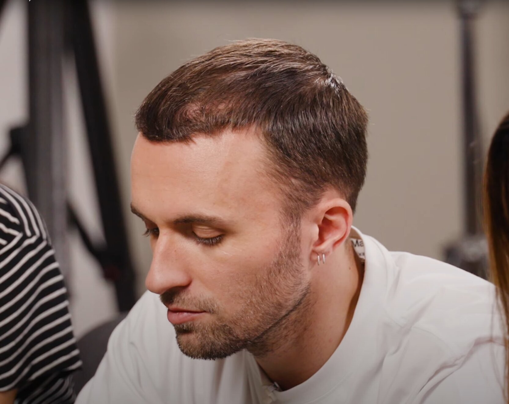 La CALV de Squeezie après sa greffe. sur le forum Blabla 18-25 ans - 15 ...