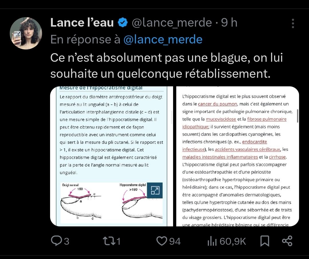 [ALERTE] Une TEEN diag un cancer des poumons à Psyhodelik sur X sur le ...